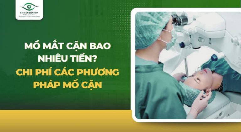 Chi phí mổ mắt cận bao nhiêu tiền? Bảng giá mổ trọn gói 2026