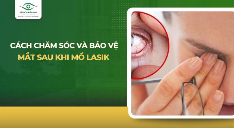 Hướng dẫn cách chăm sóc và bảo vệ mắt sau khi mổ LASIK