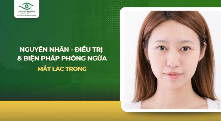 Nguyên nhân, điều trị, biện pháp phòng ngừa mắt lác trong