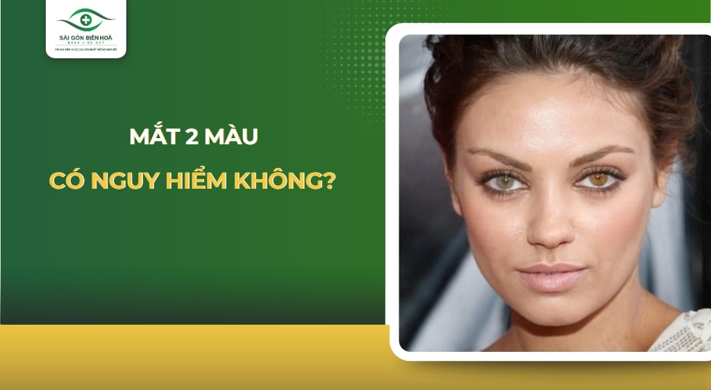 Mắt 2 màu có nguy hiểm không? Chẩn đoán và Cách điều trị